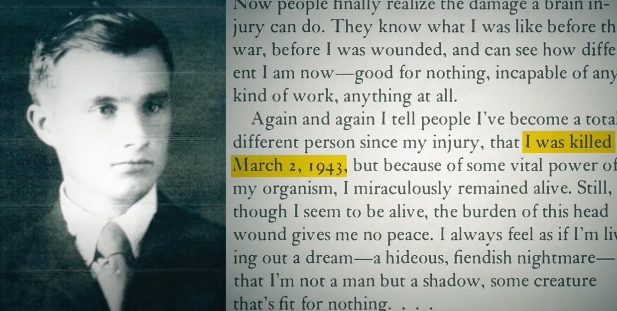 Beyni Olmadan Yaşayan Adam: Lev Zasetsky’nin Azmi ve Yaşamı